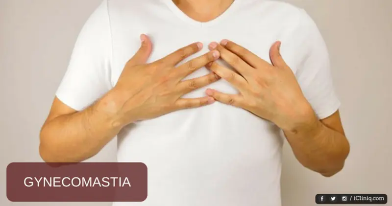 What Is Drug Induced Gynecomastia?