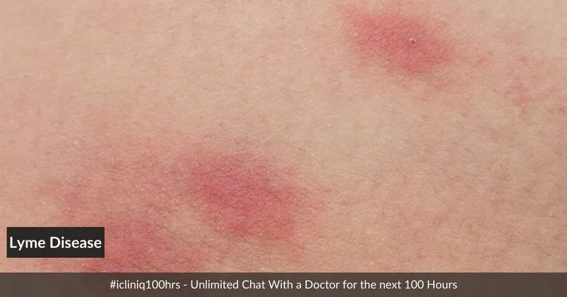 What Is Lyme Disease?