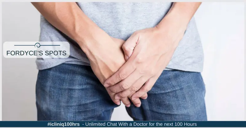 How are my Fordyce spots on my private parts treated?