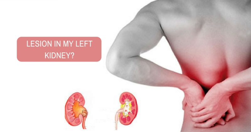 I am concerned about the growing lesion in my left kidney. Please help.