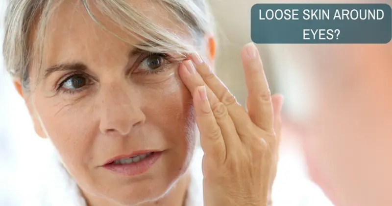 I have loose skin around my eye. Will I need surgery?
